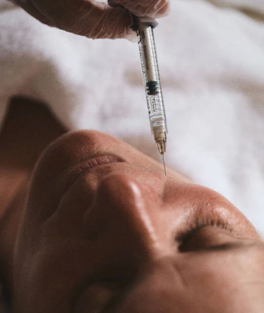 Nucleofill Skin Treatment London. Dr David Jack Clinic