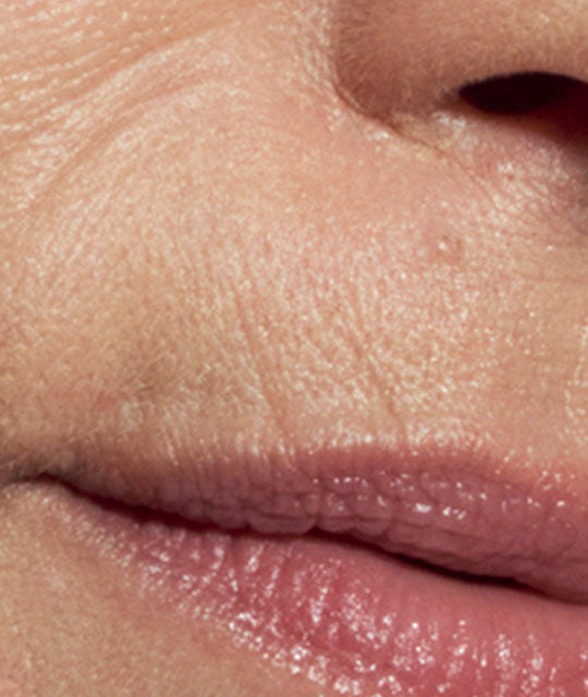 Minor Skin Surgery in London at Dr David Jack Clinic